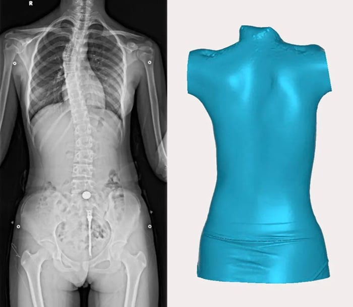 6 Ways to Utilise the ScanTech iReal 2E Colour 3D Scanner